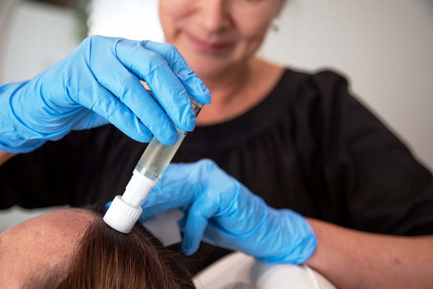 PLATELET RICH PLASMA (PRP) – Skin On Forty Five